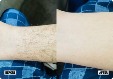 Buy 100% Organic Hair Removal Powder Online – Deyga Organics