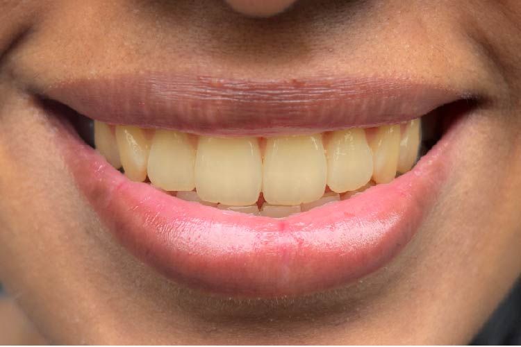 Charcoal Tooth Powder| Natural, Powerful Oral Care - Buy Now